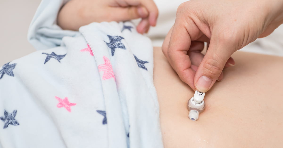 Tips to Stay Hydrated With an Enteral Feeding Tube